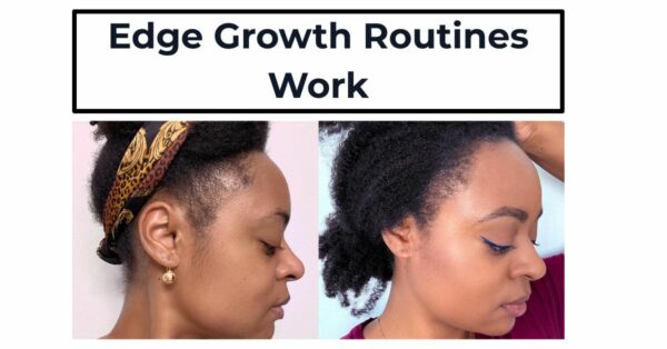 Edge Growth Routine for Black Hair (Step-by-Step Guide for Thicker ...